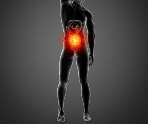Can Constipation Cause Back Pain? Exploring The Connection - Advanced ...