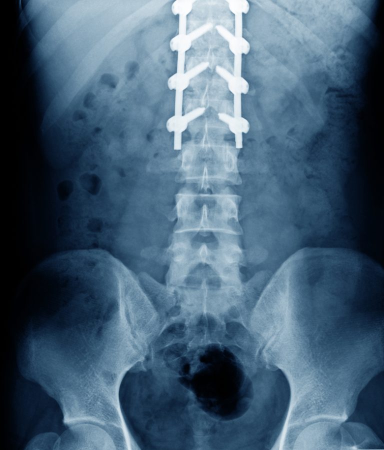 Zip Procedure: A Quick Guide To Efficient File Compression - Advanced ...