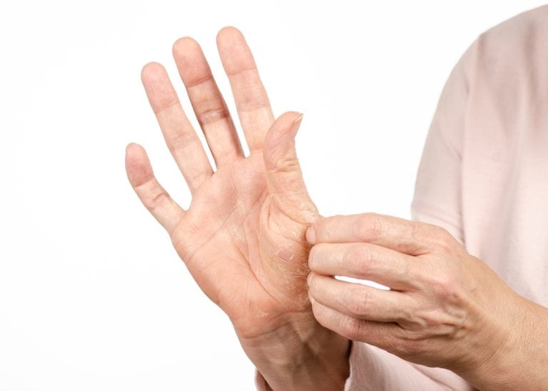 Finger Joint Pain After Weight Lifting: Causes and Remedies - APM Health